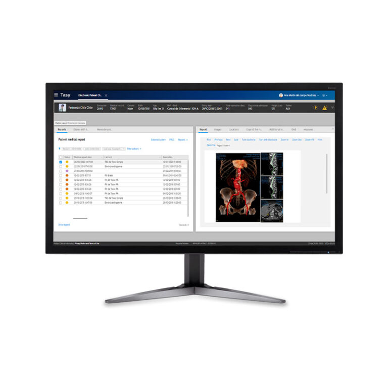 Sistema de Gestión Hospitalaria Philips Tasy - EMR | Agimed